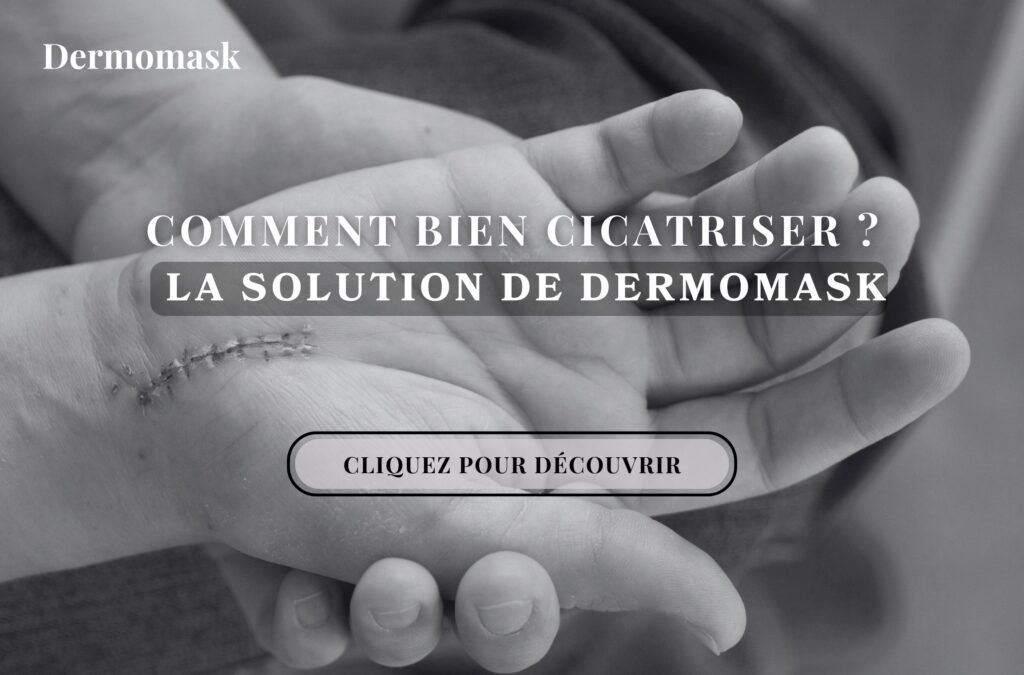 Comment cicatriser correctement pour éviter une mauvaise cicatrice